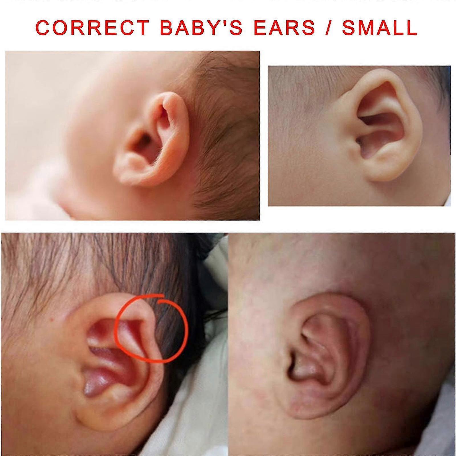 Ear Correction Tape Ear Cleaner Tool Kit Newborn Baby Ear Aesthetic ...