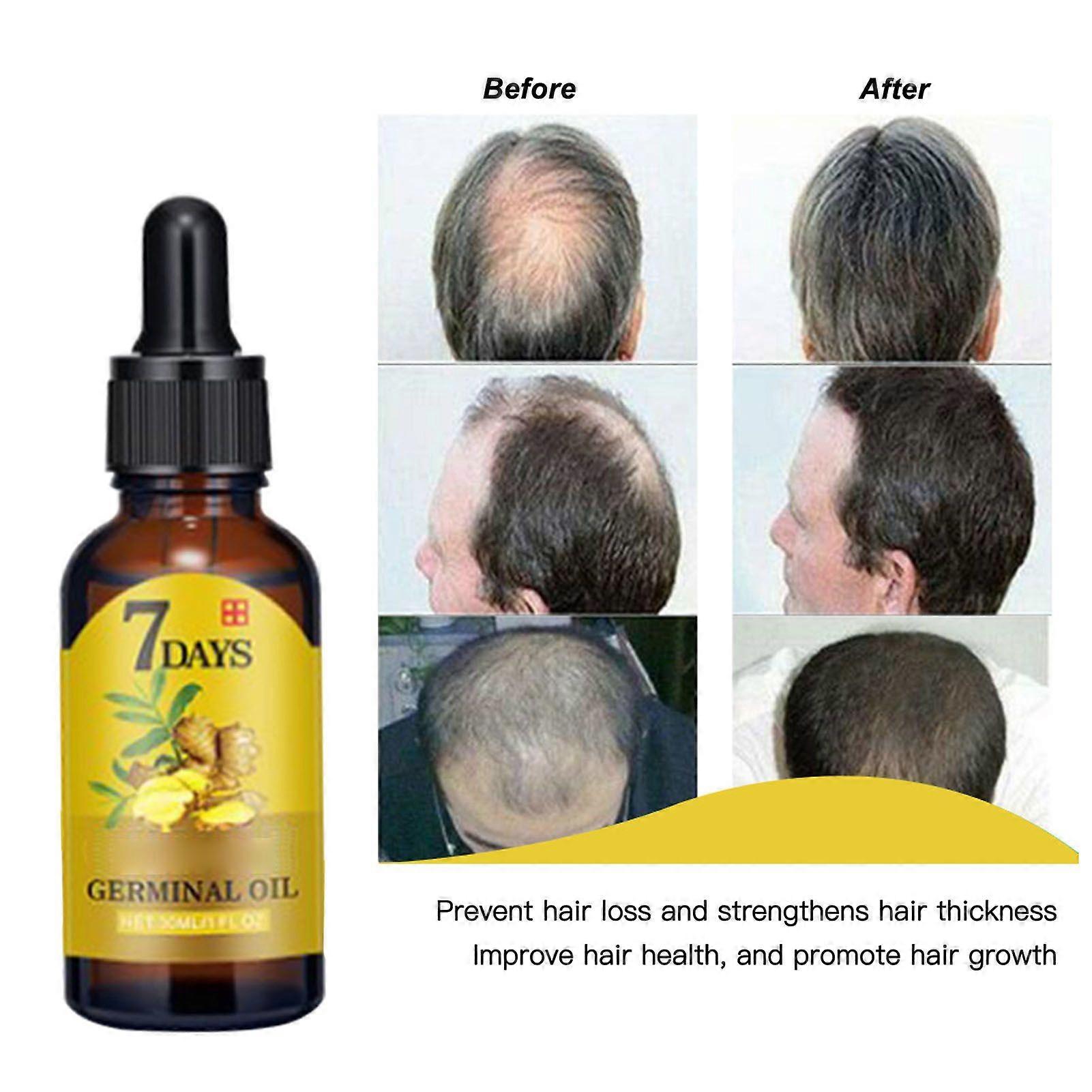 Ginger Hair Growth Serum Deep Nourishing Repair Hair Root Hair Regrowth ...