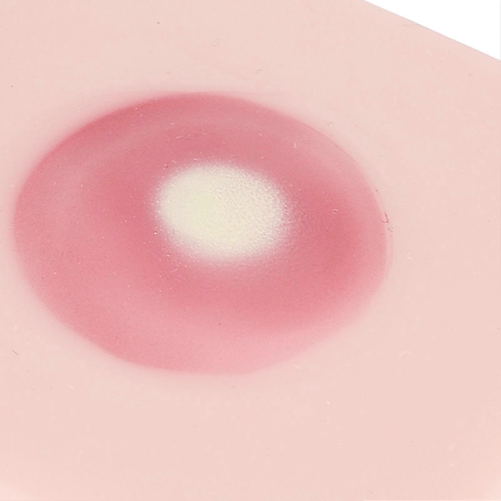 Abscess Incision Drainage Pad Sebaceous Cyst Surgical Removal Training ...