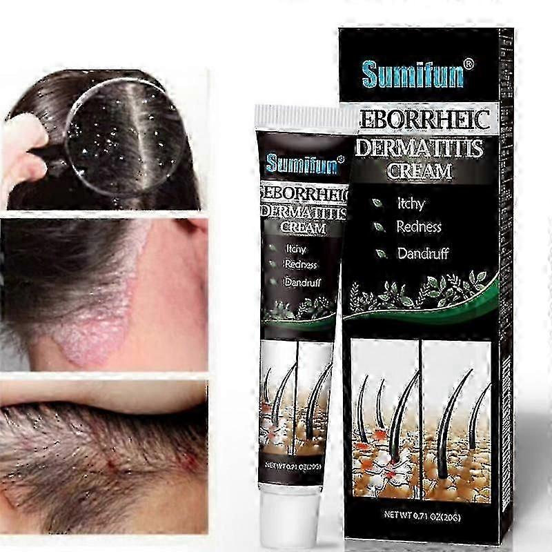 Treatment Of Psoriatic Seborrheic Dermatitis Cream Head Acne Pruritus ...