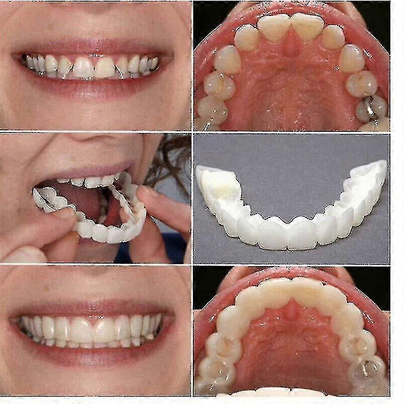 Snap On False Teeth Upper + Lower Dental Veneers Dentures Tooth Cover ...