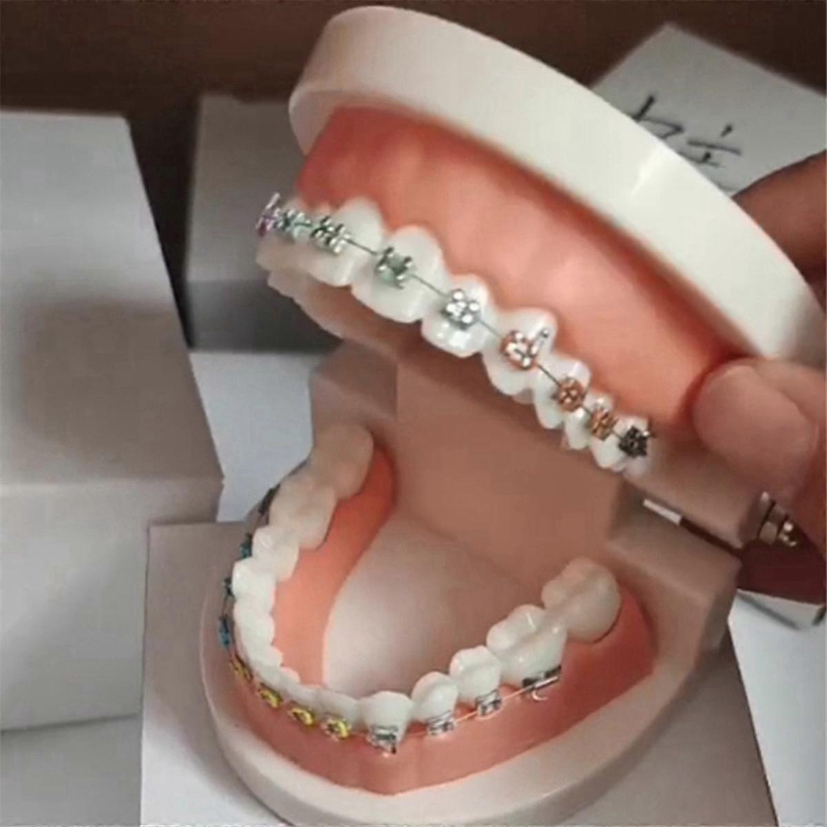 Dental Orthodontic Treatment Teeth Model with Bracket Arch Wire Buccal ...