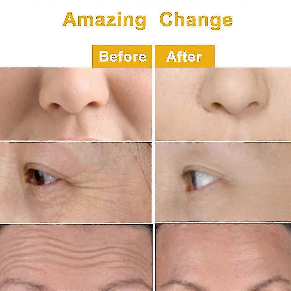 Ltcmfc 24k Beauty Bar Golden Face Massager, 3d Roller Electric Sonic ...