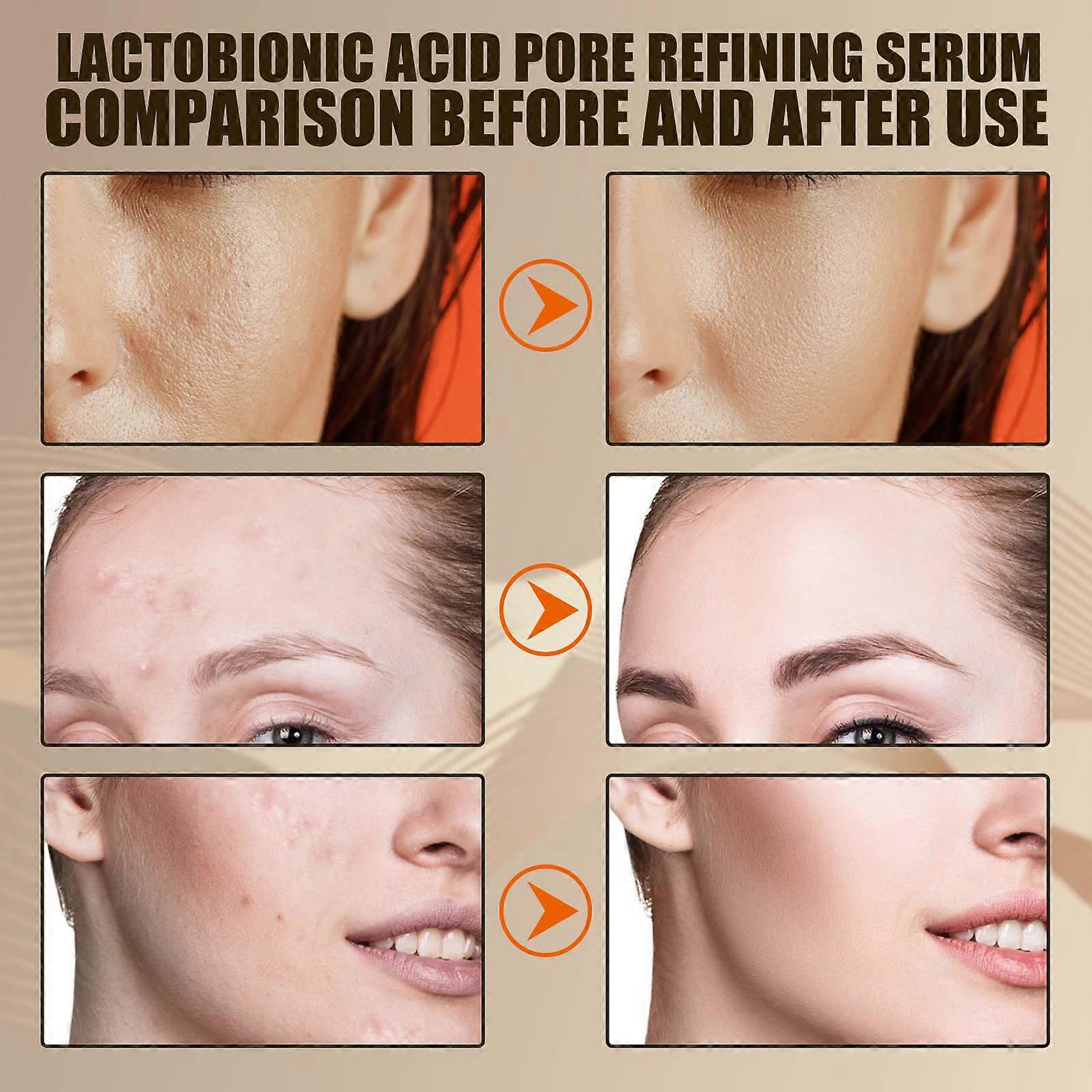 Lactobionic Acid Pore Refining Serum, Shrink Pore Reduce Fine Lines ...