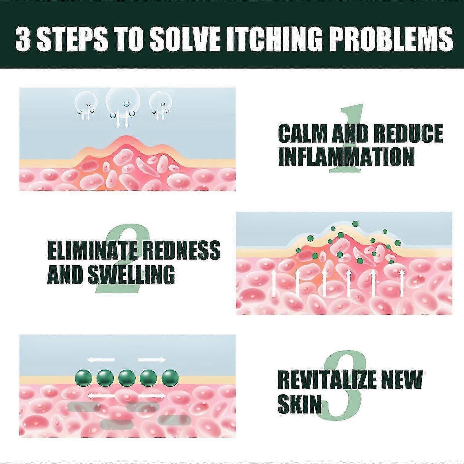 South Psoriasis Cream Repairs Psoriasis, Tinea Pedis And Tinea Pedis To ...