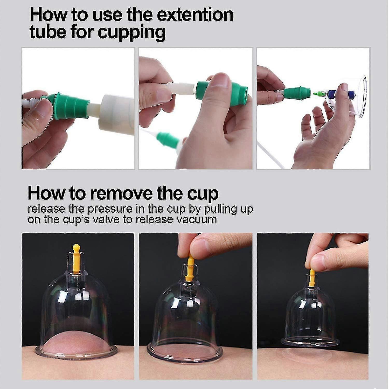 Cupping Therapy Sets,24 Cups Cupping Set With Pump Vacuum Suction Cups ...