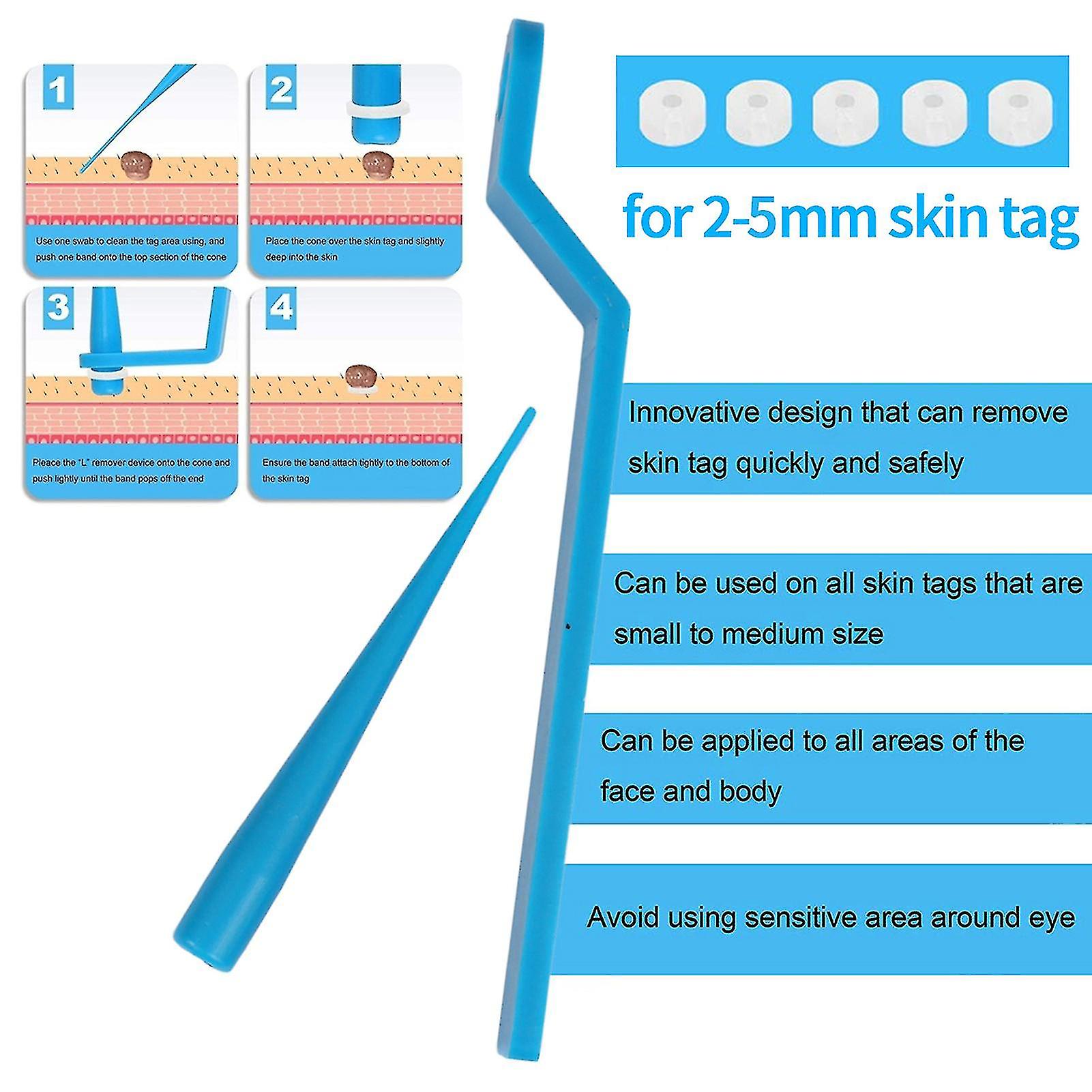 Skin Tag Remover Device Set Mole Wart Convenience Remover Device For 2 ...