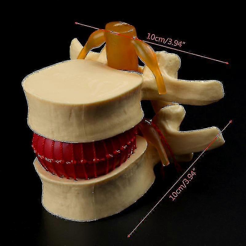 Medical Props Model Free Postage Anatomical Spine Lumbar Disc ...