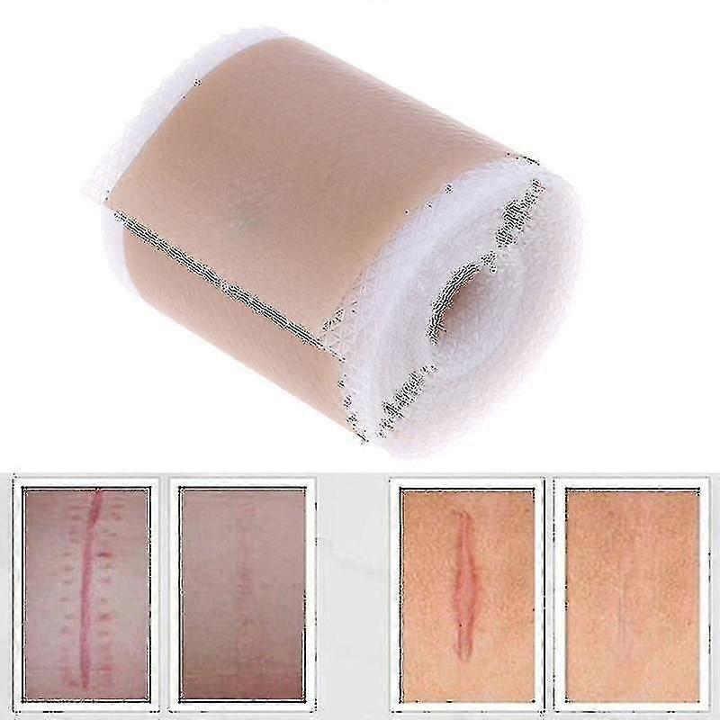 Efficient Surgery Scar Removal Silicone Gel Sheet Therapy Patch For ...