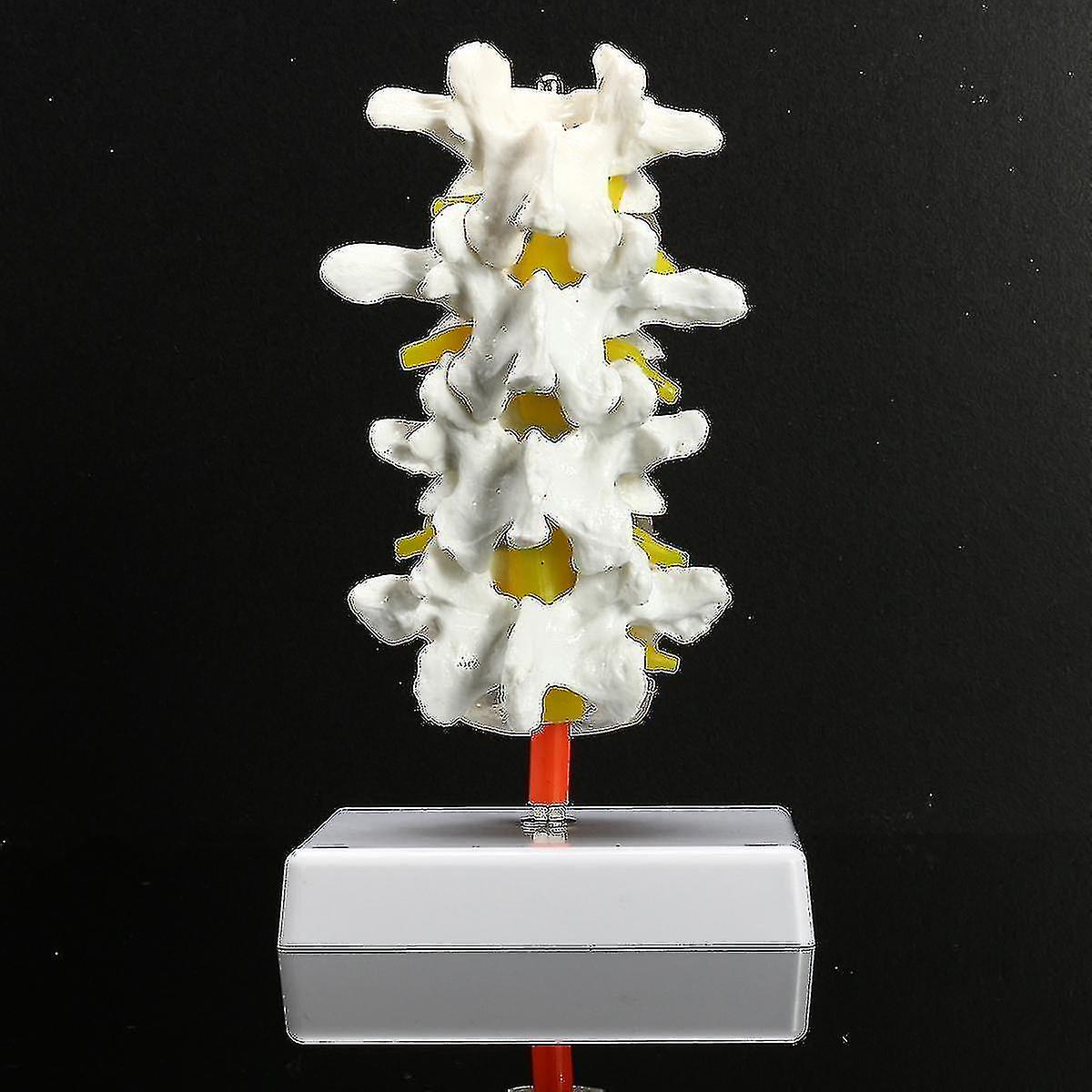 4 Part Chiropractic Human Anatomical Lumbar Vertebrae Spine Anatomy ...