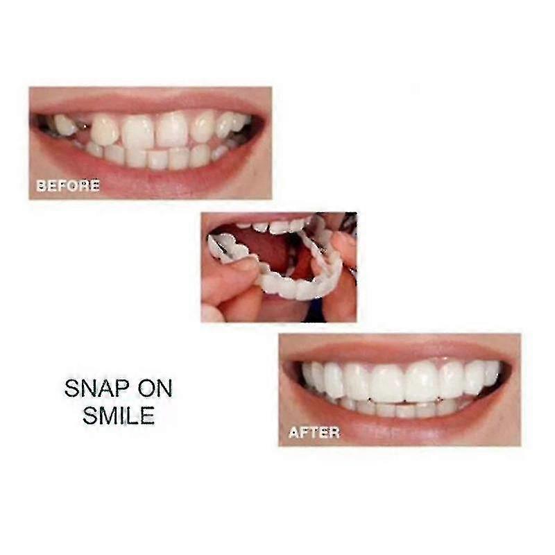 Reusable Denture Braces No Drilling Temporary Fake Teeth Veneers Snap ...