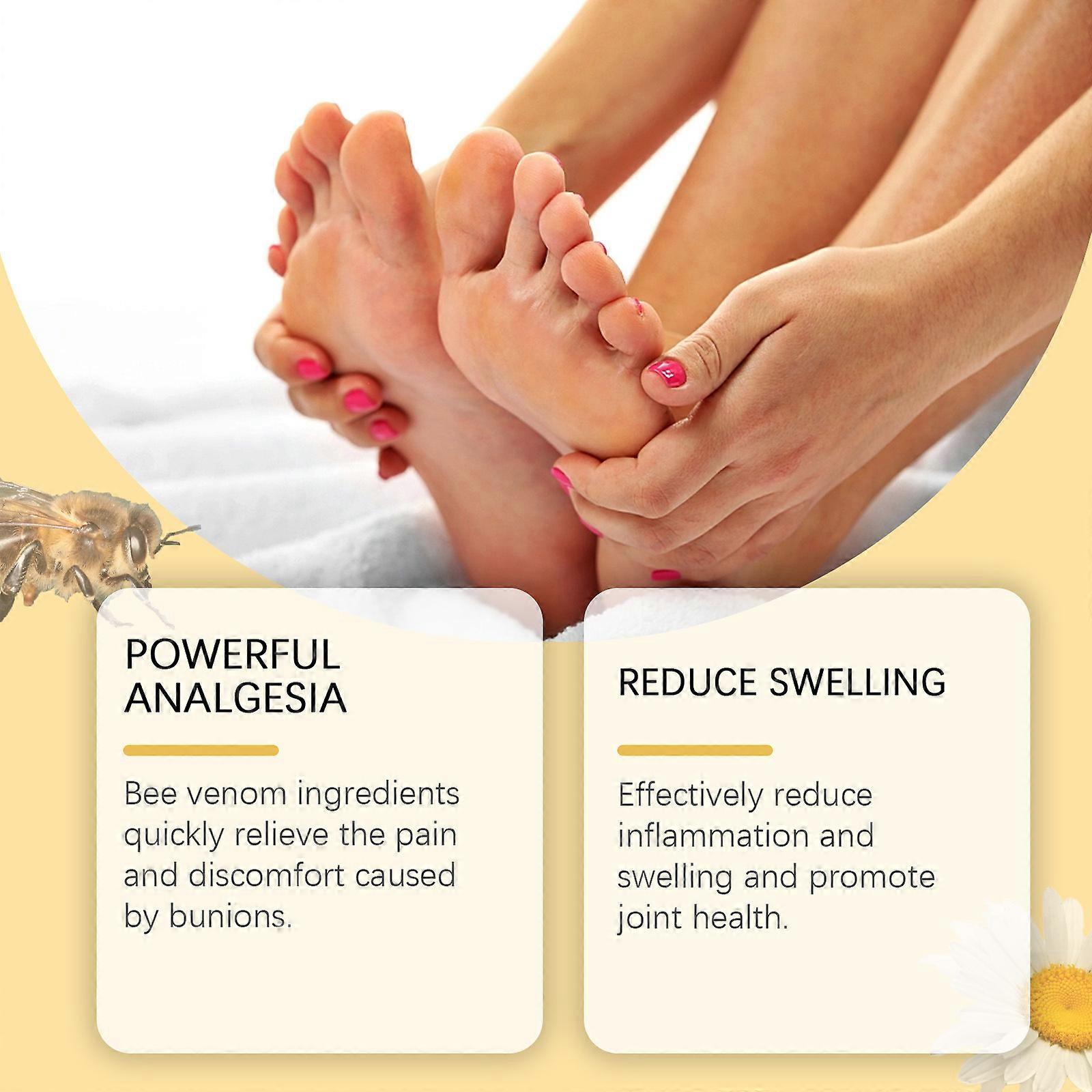 Bee Venom Bunion Care Cream, Support Hallux Valgus Hammer Toe Pain ...