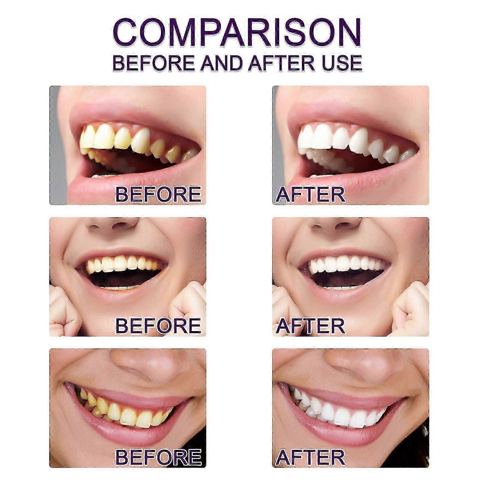 Eelhoe V34 Purple Tooth Pen Oral Cleaning Tooth Stain Removal Shiny ...