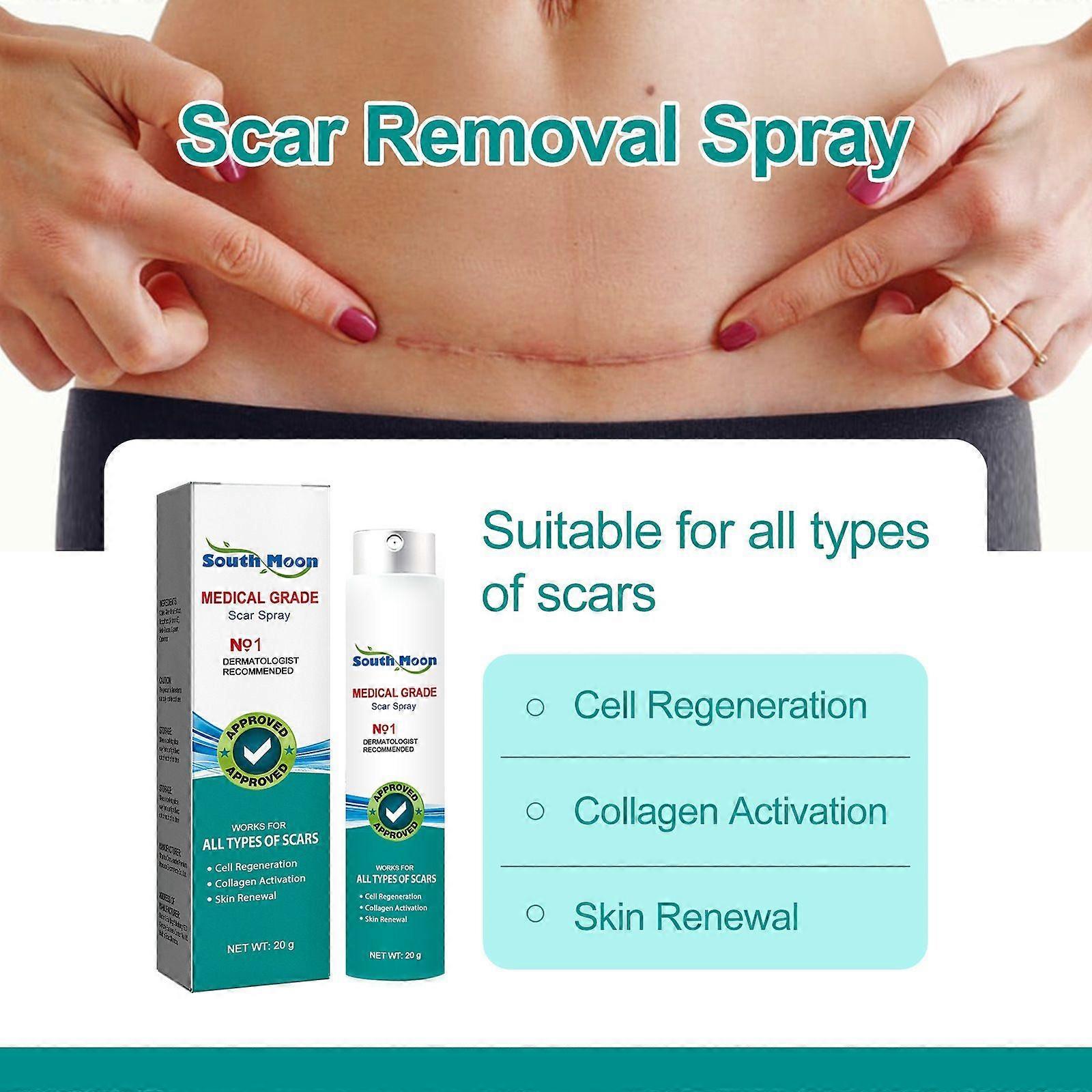 2PCS Scar Remove Advanced Spray For All Types Of Scars, Especially Acne ...