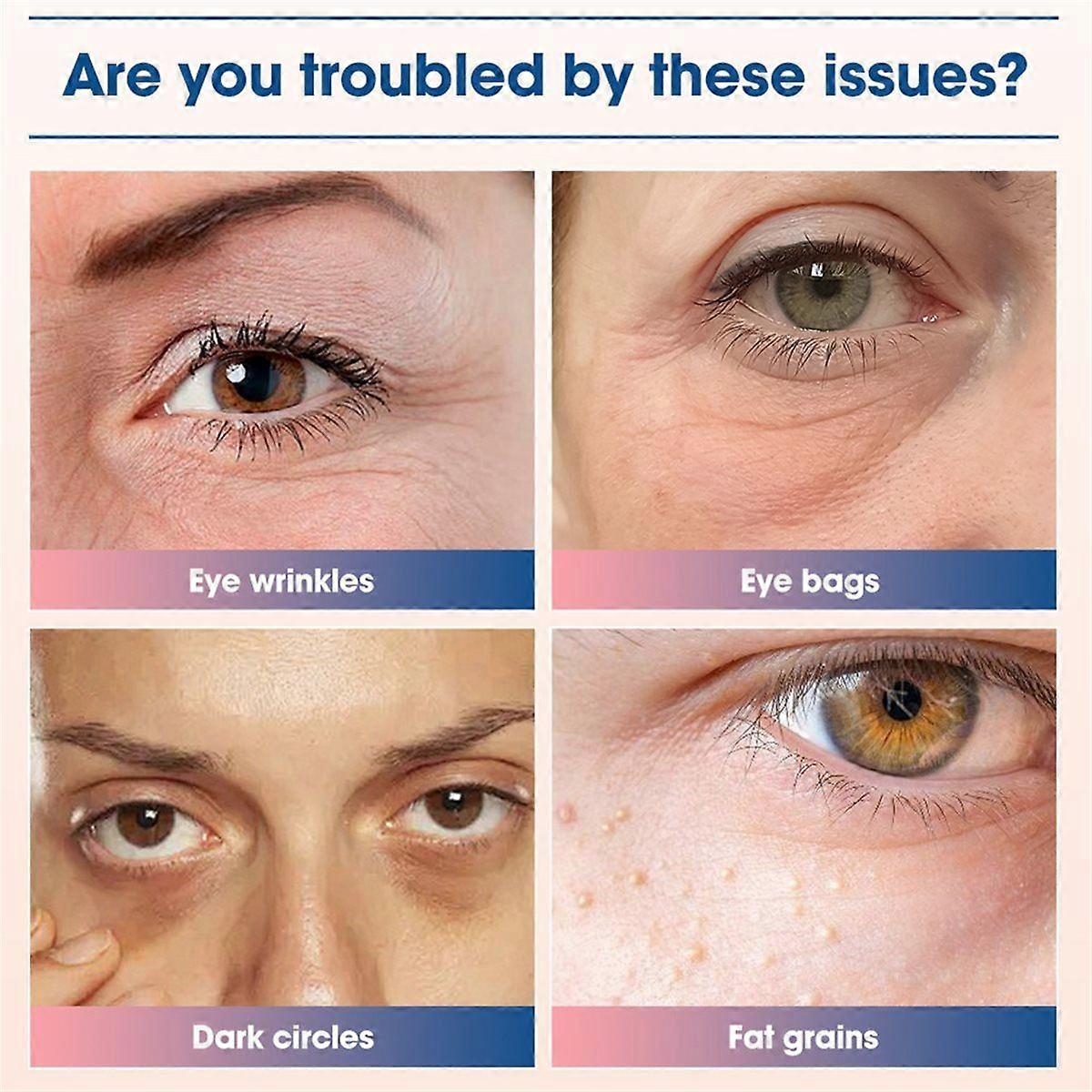 Micro-Current Eye Massager Red Light Pulse Face Massage Face Eye Beauty ...