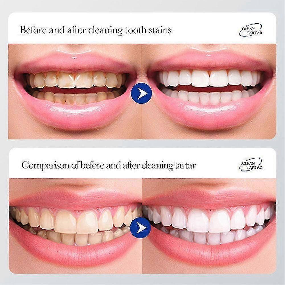 Livfresh Toothpaste Gel, Clinically Proven To Remove Plaque 250% Better ...