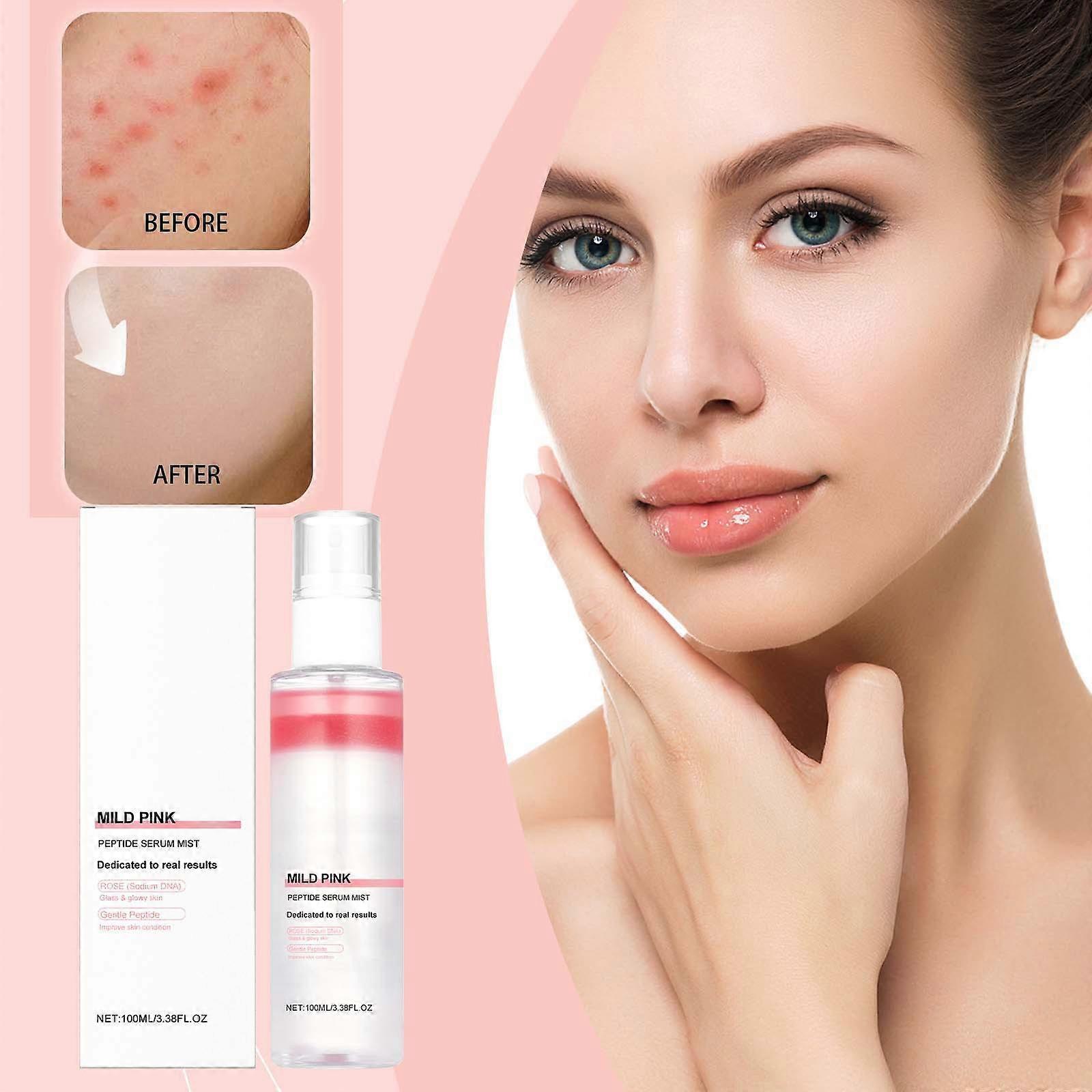 Rose Moisturizing Spray Toner Oil Control And Pore Shrinking Suitable ...