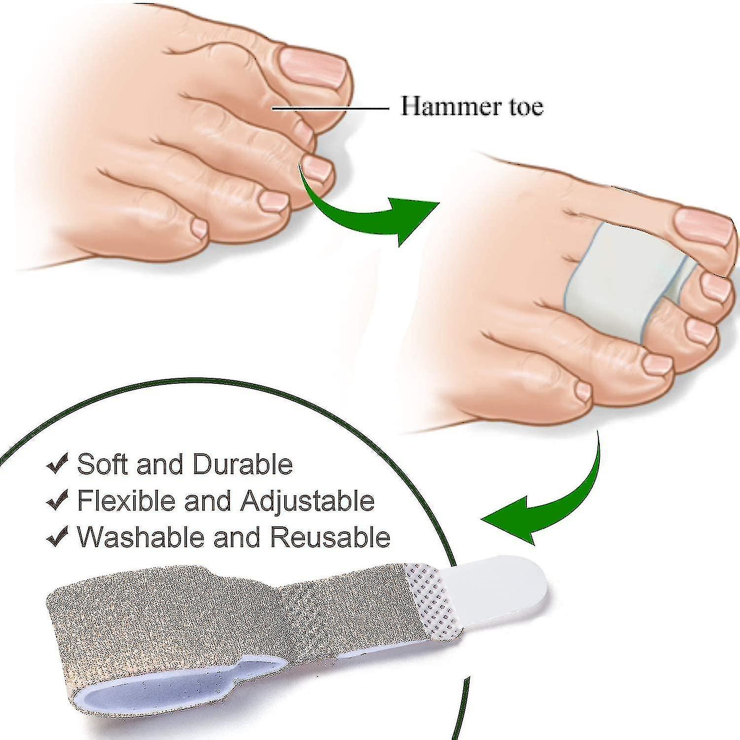 6-pack Of Hammer Toe Straighteners For Straightening Hammer Toes ...