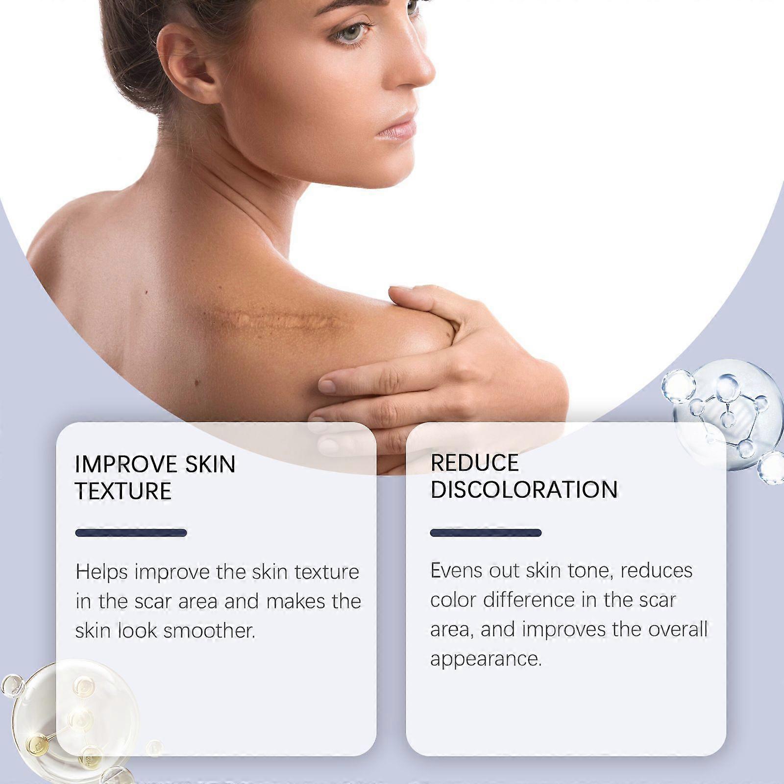 Advanced Scar Gel for Face & Body, Scar Treatment for Surgical Scars ...