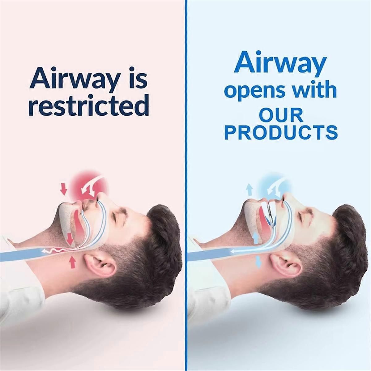 Adjustable Anti Snoring Mouth Guard Braces Sleeping Anti-Snoring ...