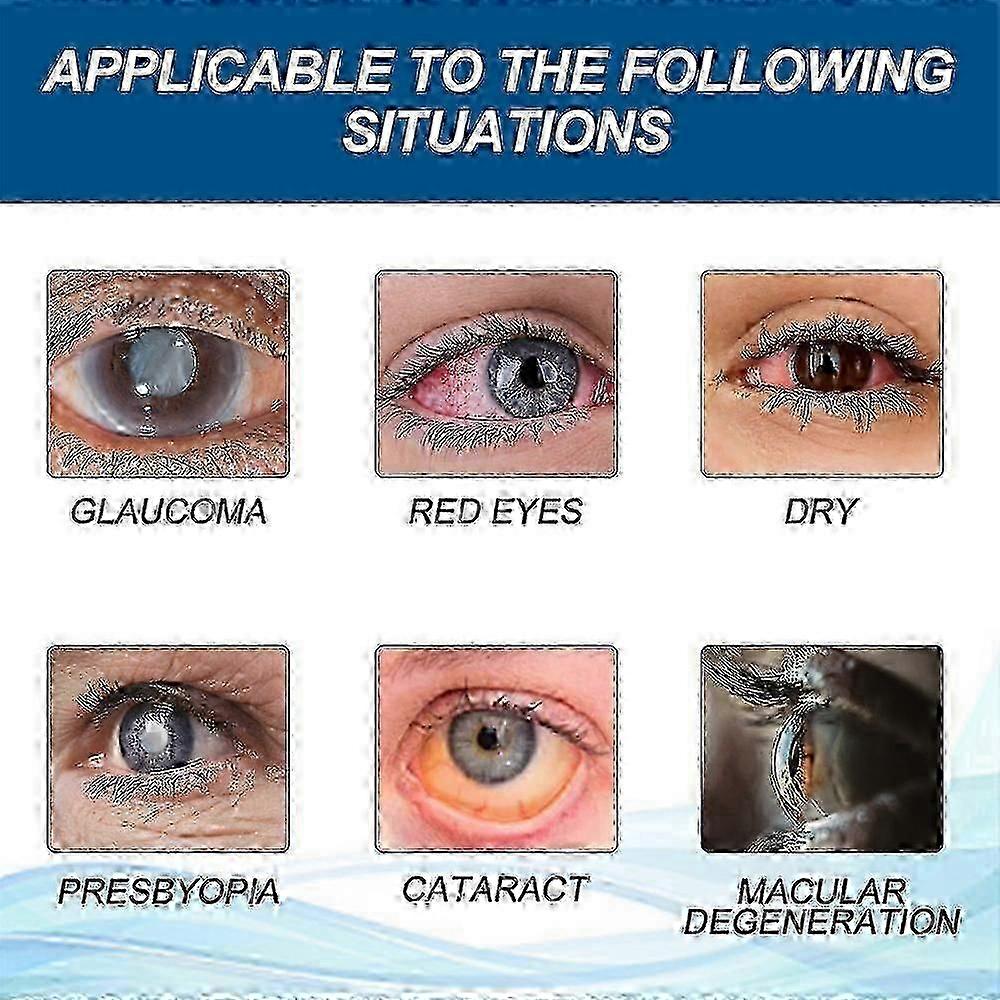 Eye Drop Improve Blurred Vision Restore Eyesight Relieve Eyeball ...