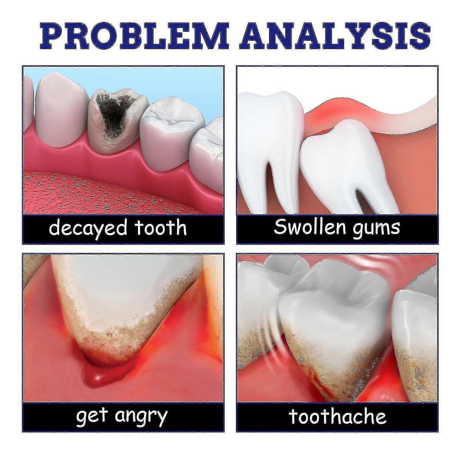 3pcs Toothache Spray Gum Swelling Toothache Toothache Water Licorice ...