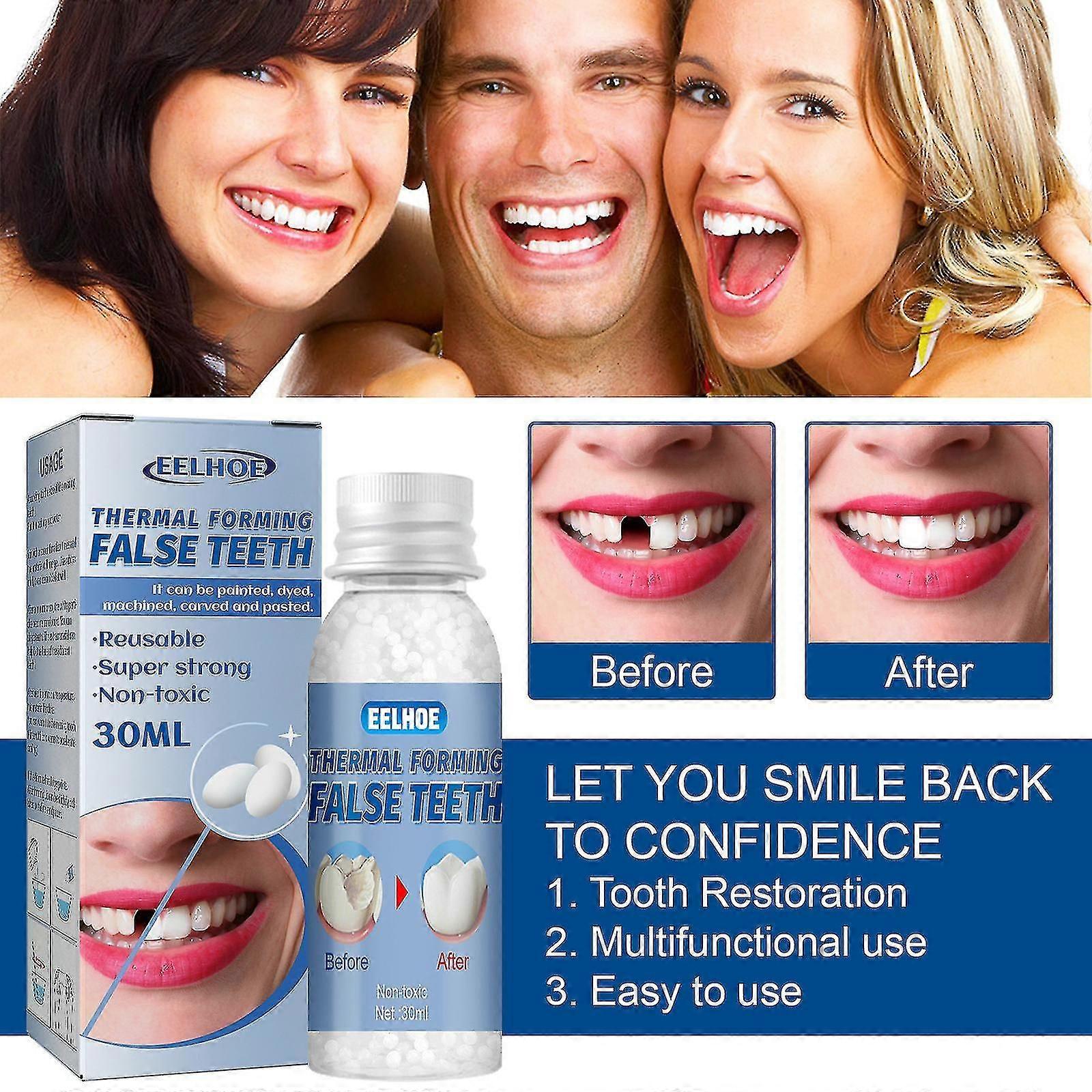 Shapeable Dental Cement Temporary Tooth Filling Replacement Dental ...