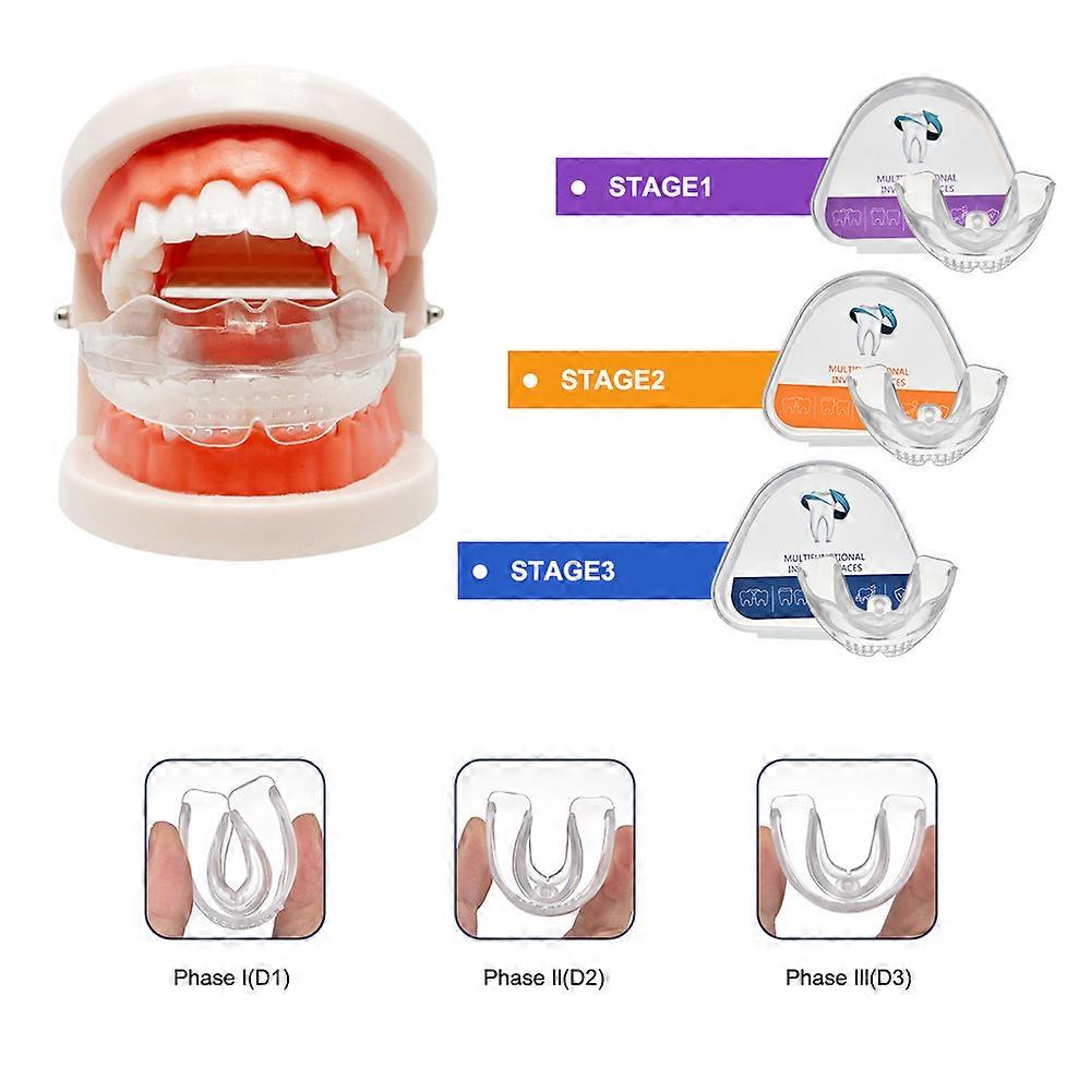 3 Pcs 4d Invisible Braces Transparent Orthodontic Braces For Adult And ...