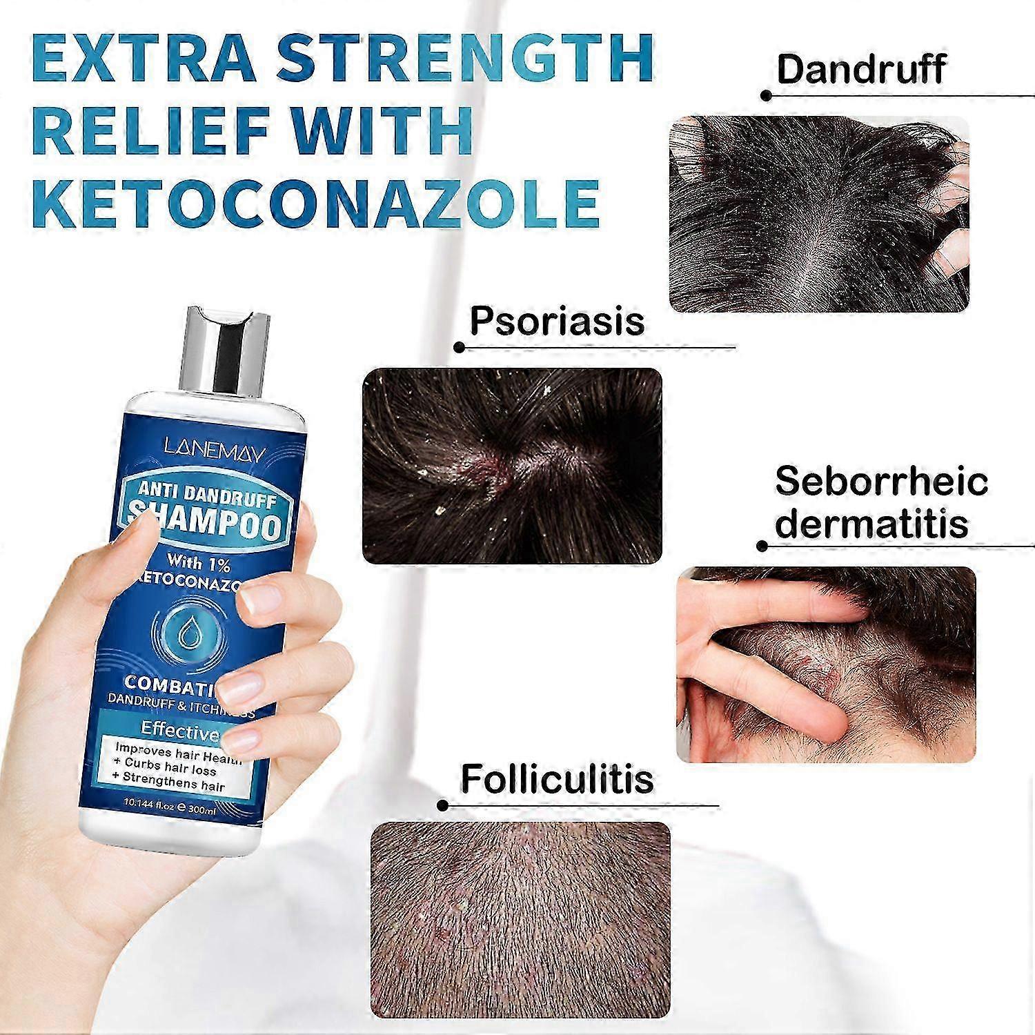 Anti-Dandruff Shampoo & Seborrheic Dermatitis Cream Set, Scalp ...