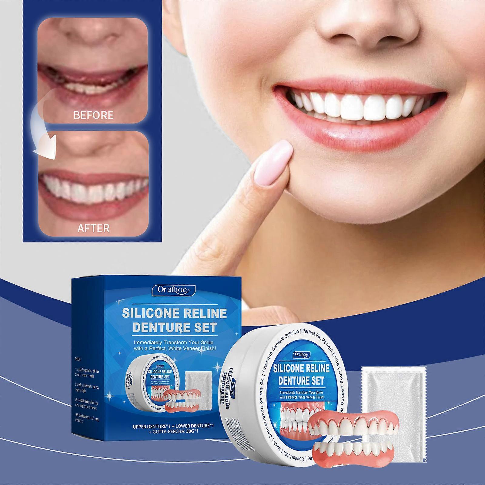 FeiKong Kit de rebase de silicona para prótesis dentales, kit de rebase ...