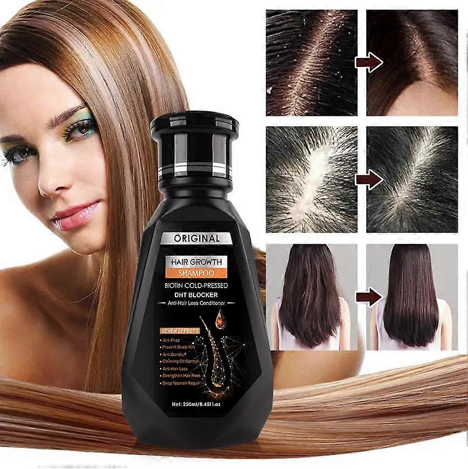 Ginger Essence Shampoo Anti Hair Loss Oil Control Dandruff Removal ...