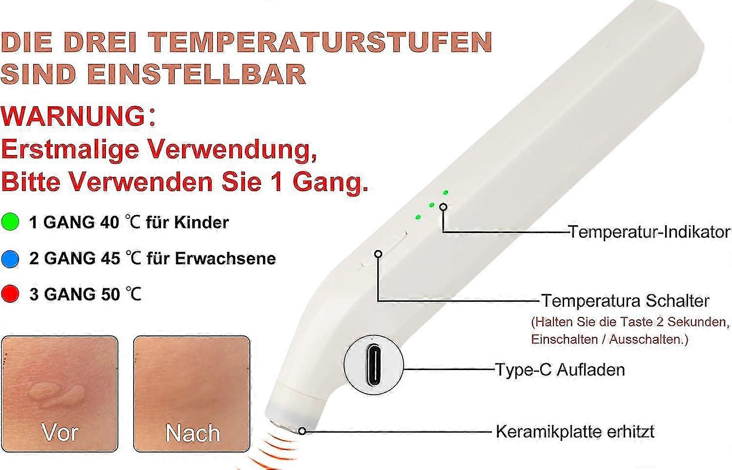 Electric Insect Bite Healer, Insect Bite Healer, Electric Bite Healer ...