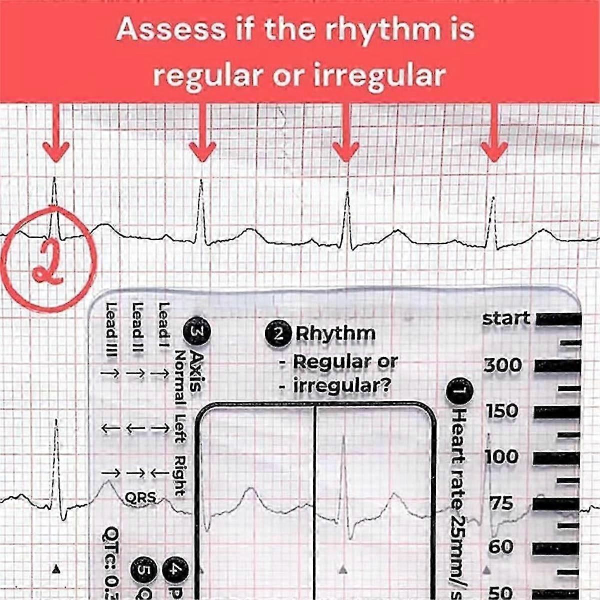 2pcs ECG 7 Step Ruler,ECG 7 Step Ruler for ECG/EKG Interpretation,ECG ...
