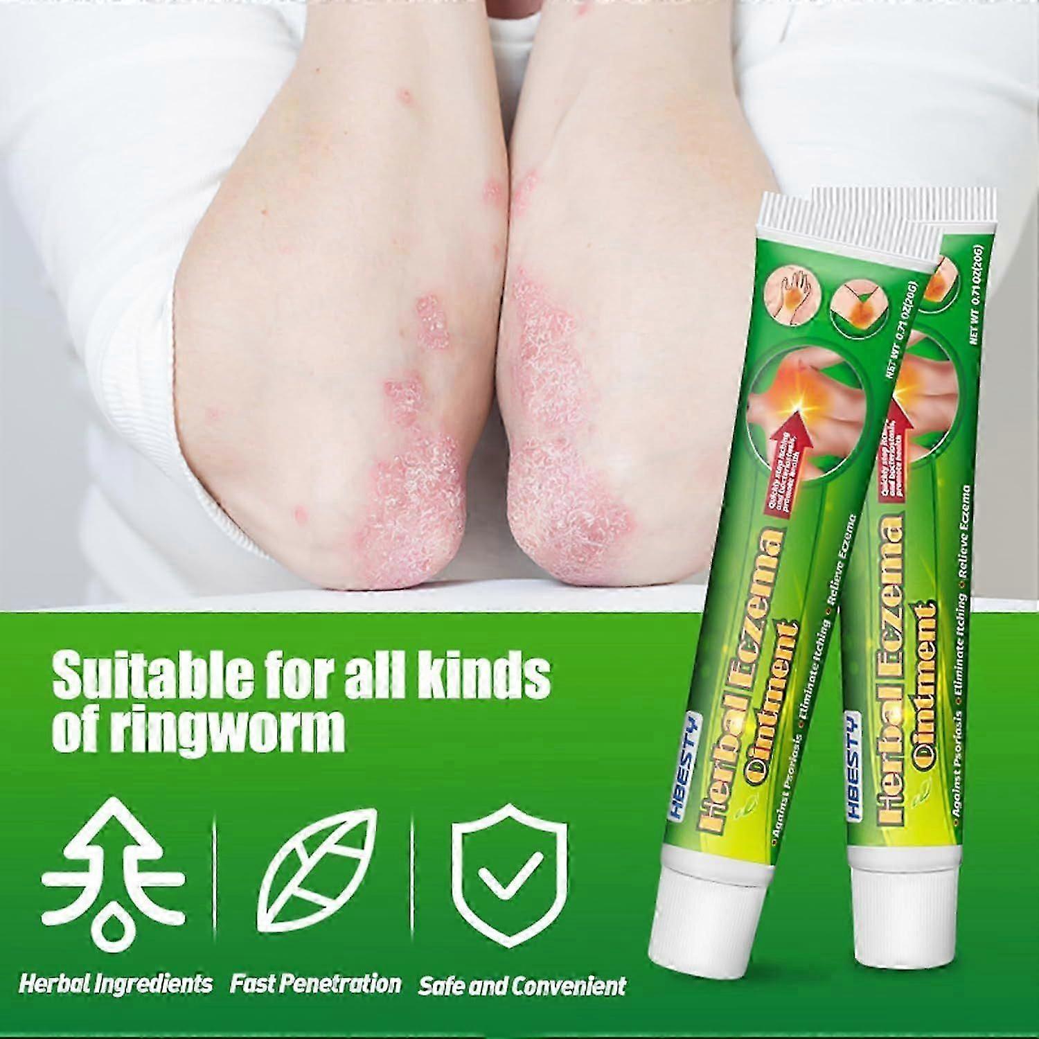 Antifungal Cream 20g - Anti Fungal Skin Cream Relief Jock Itch, Ringworm, Eczema, Antifungal ...