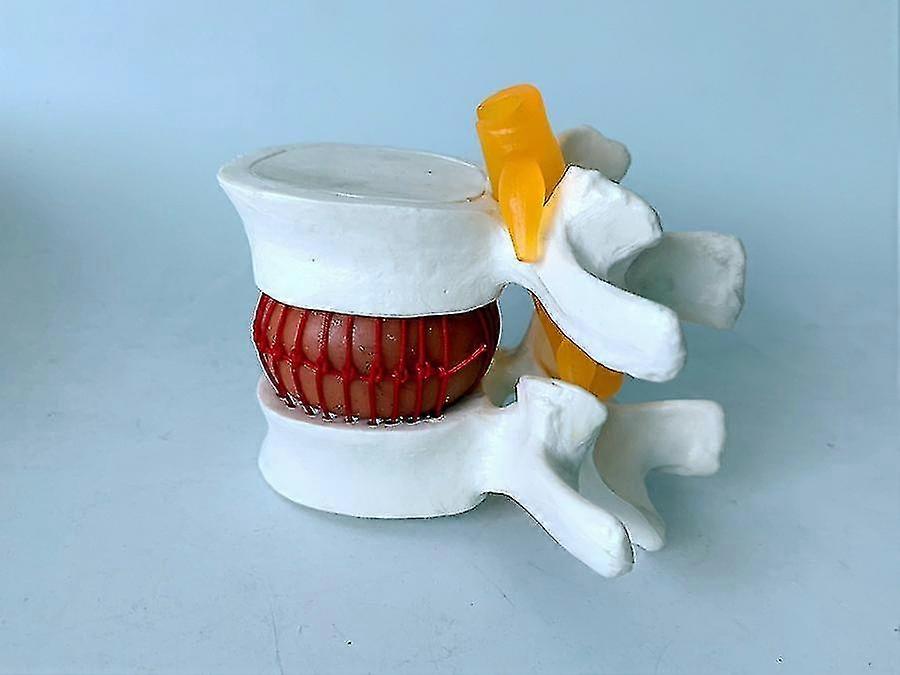 human Spine Model Vertebrae Lumbar Intervertebral Disc Model Vertebral ...
