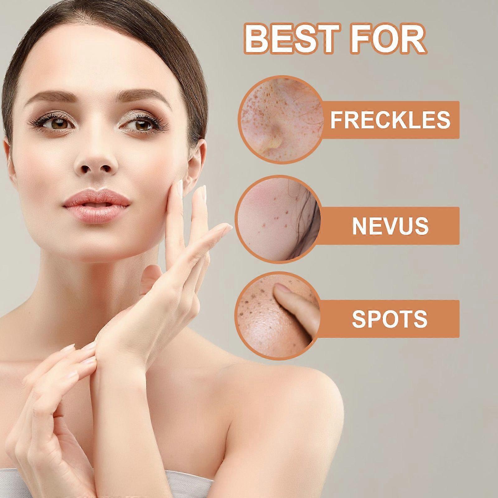 Eliminate Nevus Potion, Remove Nevus Repair And Remove Warts Cleaning ...