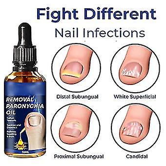 3pcs German Toenailcare Oil For Removing Paronychia, Nail Care And ...