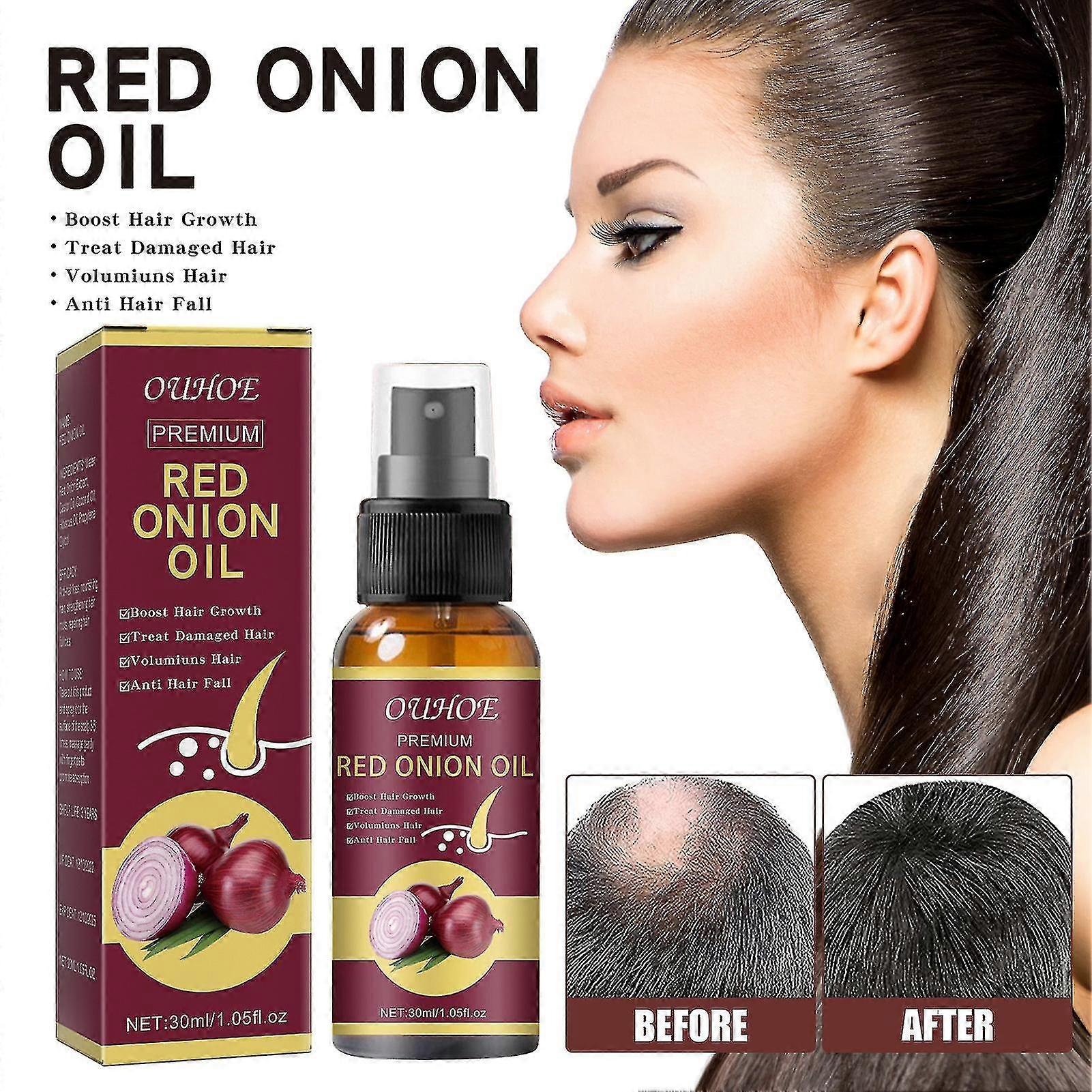 Onion Hair Growth Spray With Healthy Herbal Formula Spray For Stronger ...