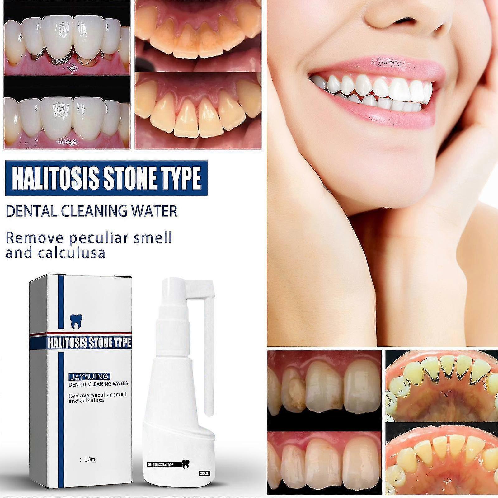 Tartar- Dissolving Spray Tartar Removal Teeth Cleaner Powerful Stain ...