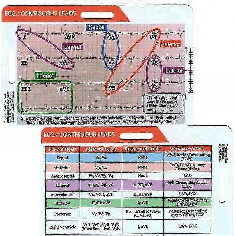 ECG/EKG Rhythm Pocket Card, Double Sided EKG Cardiac Badge Card | Fruugo UK