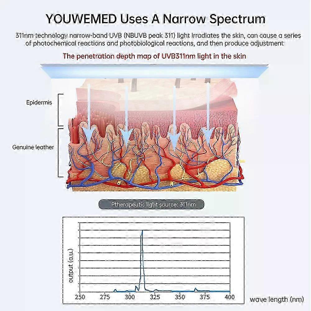 UV 311nm Ultraviolet Phototherapy Device Utilizes a Compatible UVB Lamp ...