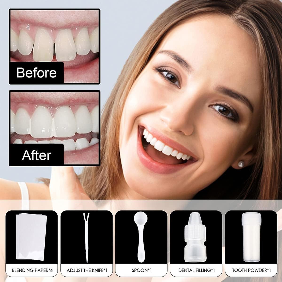 Tooth Repair Kit Temporary Fake Teeth Replacement Glue Kit Replacement ...