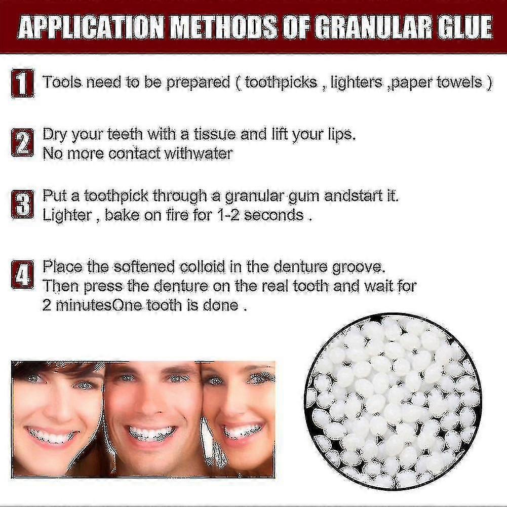 Repair Cement Teeth Gap Falseteeth Solid Glue Set Tooth Filling Kit ...