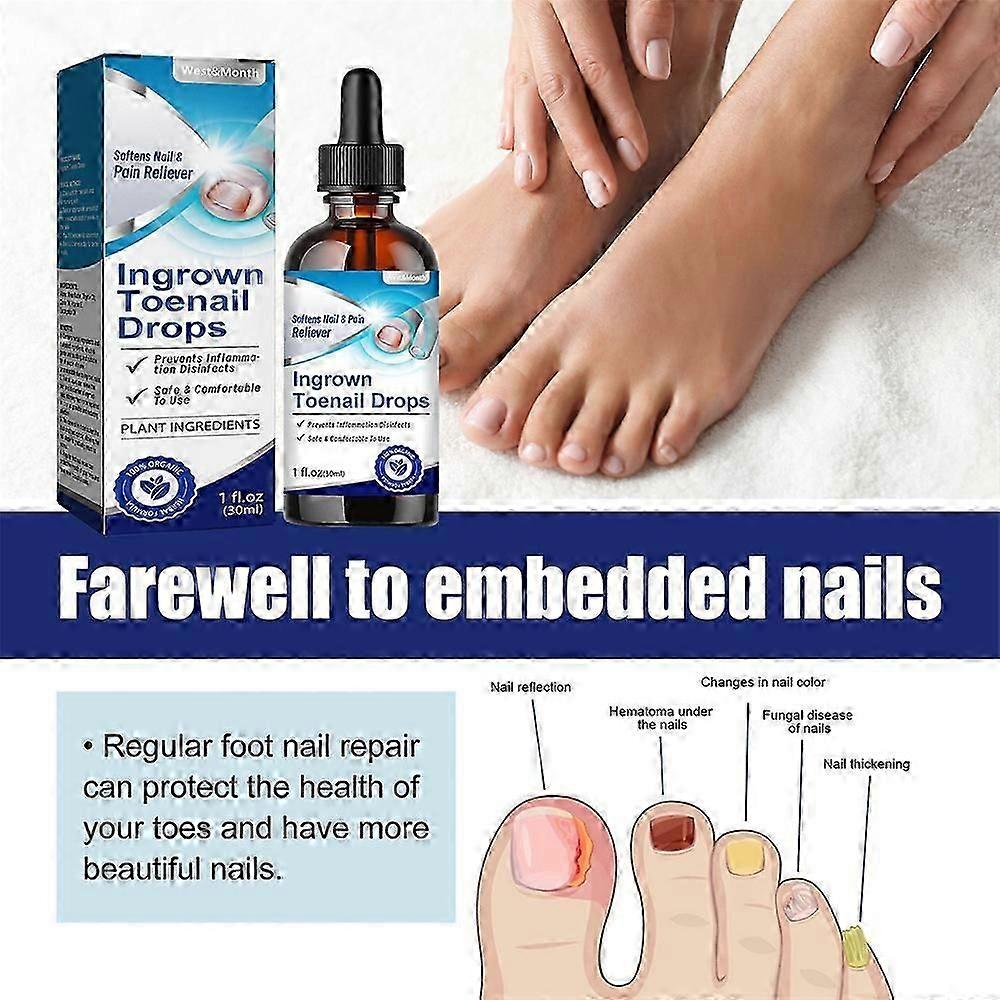 Ingrown Toenail Drops, Ingrown Toenail Treatment, Cuticle Care Oil For ...