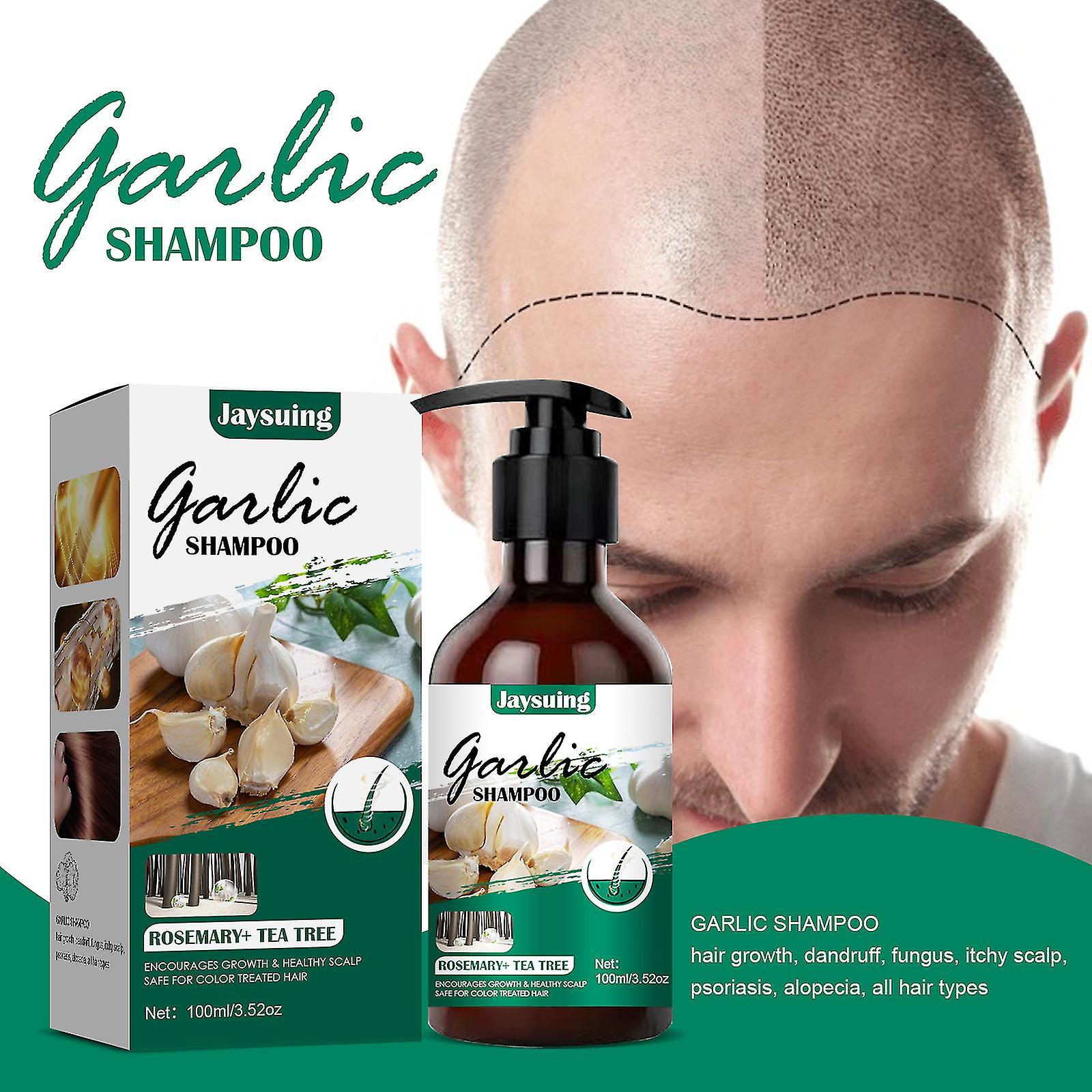 Garlic Shampoo - Anti-itch, Anti-dandruff, And Nourishing Hair Growth ...