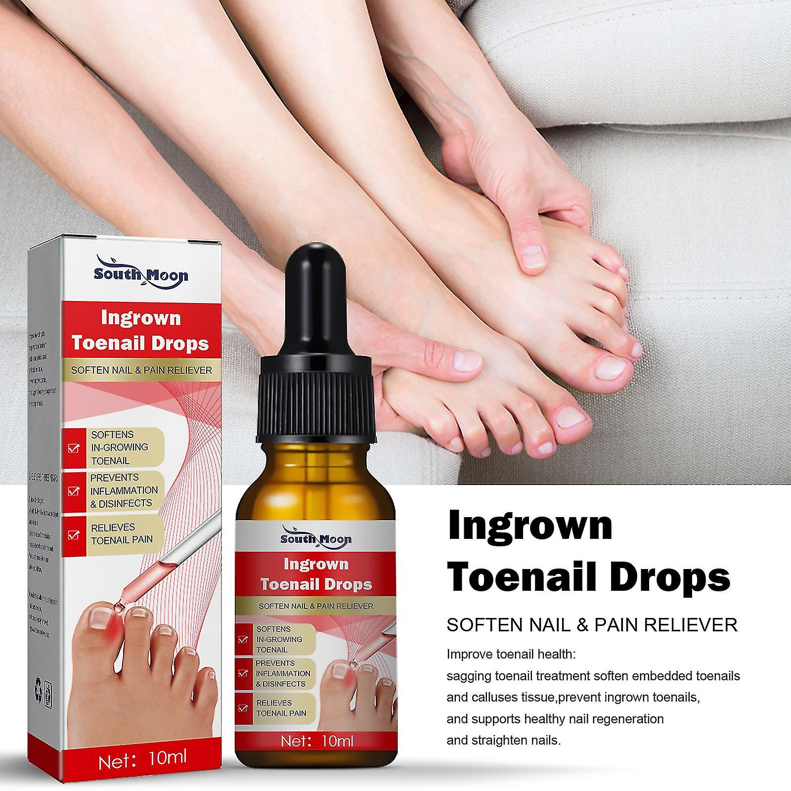 30ML Ingrown Toenail Treatment,nail Growth Treatment,ingrown Toenail ...