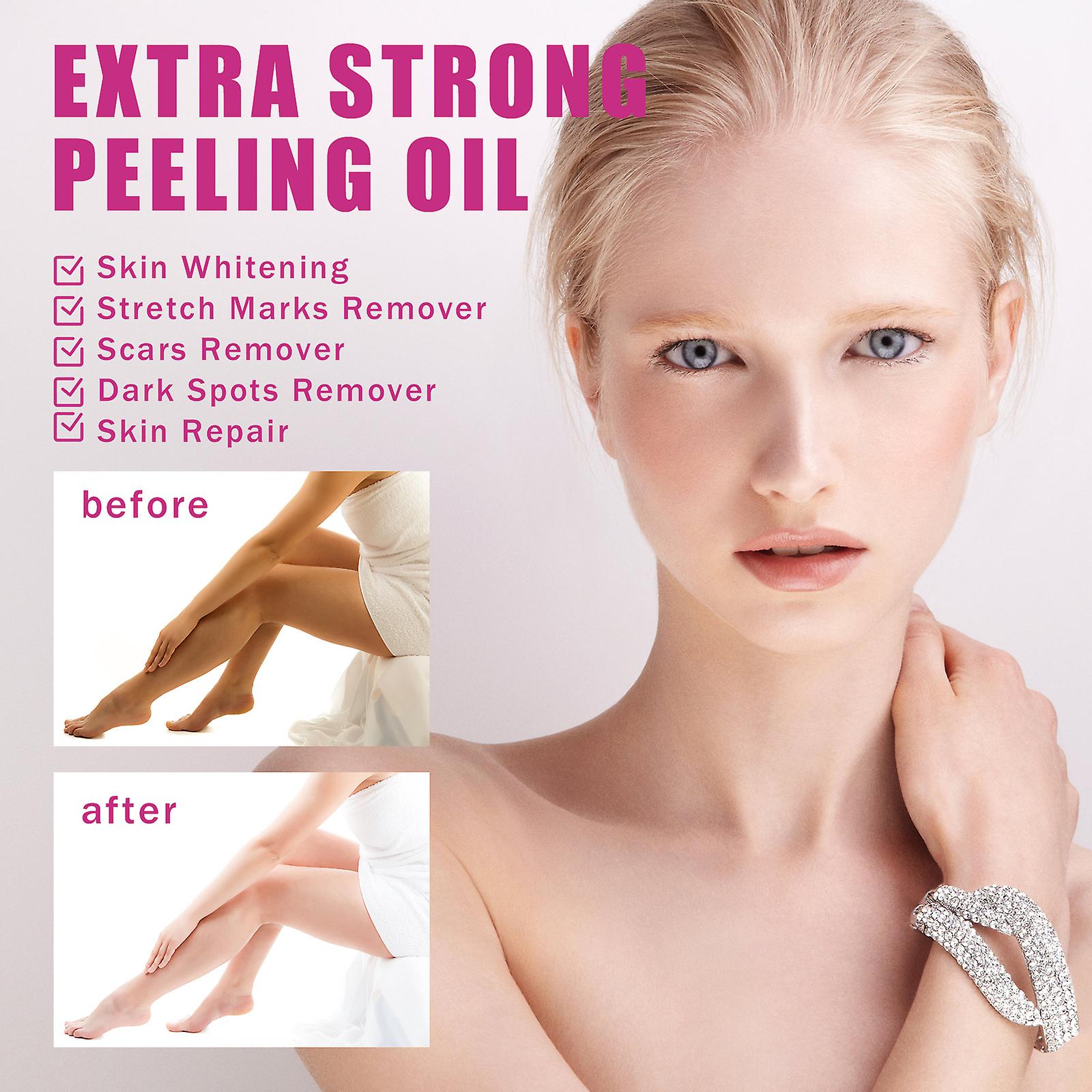 Peeling Oil For Dark Skin, Yellow Peeling Oil With Salicylic Sodium ...