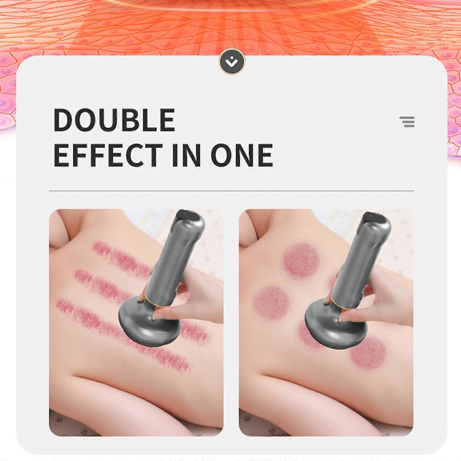 Cupping Set Gua Sha Massage 3 In 1 Smart Cupping Therap-y Set 6 Gear ...