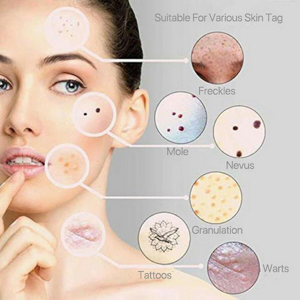 Blue Light Therapy Pen for Acne Spider Veins Scar Removal Dark Circles ...