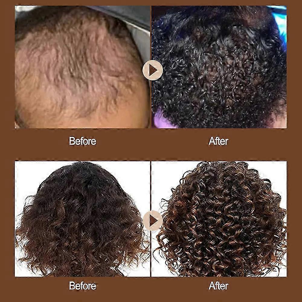 Sevich Batana Butter Hair Growth Liquid Growth Liquid Hair Roots Strong ...